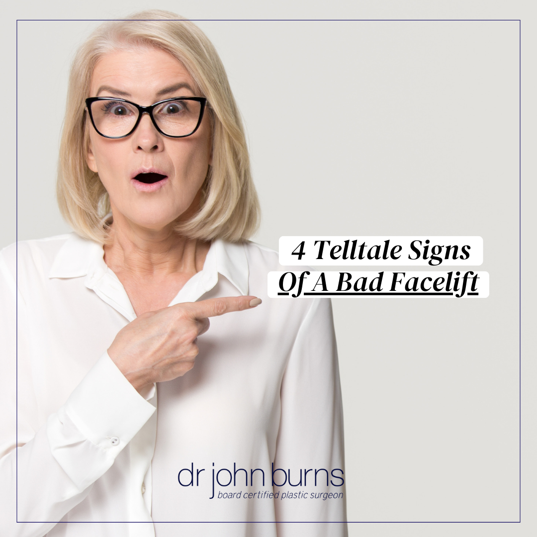 4 Telltale Signs Of A Bad Facelift-Dallas Facelift- Dr. John Burns – Dr ...
